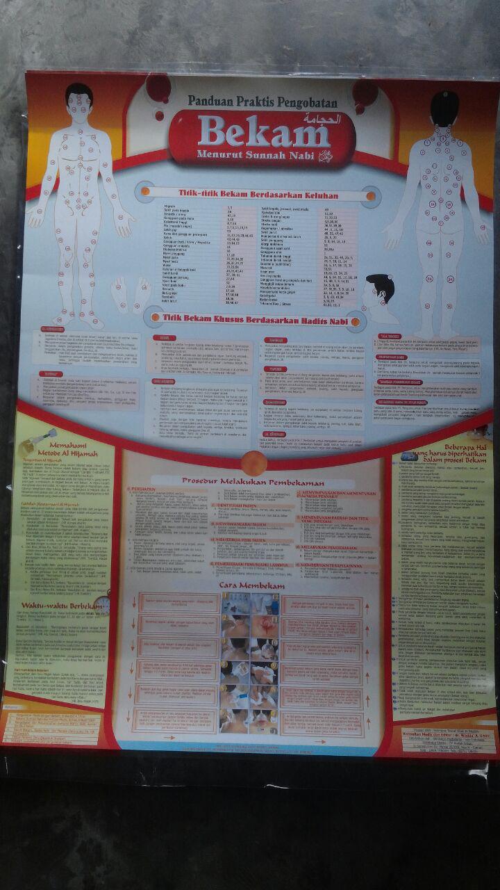 Poster Panduan Praktis Pengobatan Bekam
